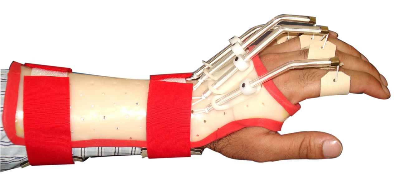 Dynamic wrist hand finger splint - Lifestyle Treatment